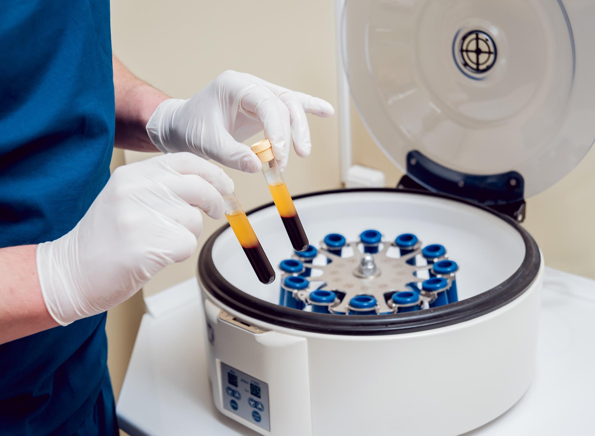 Orthopedic PRP and Stem Cell Therapy Services in Beverly Hills, CA ...